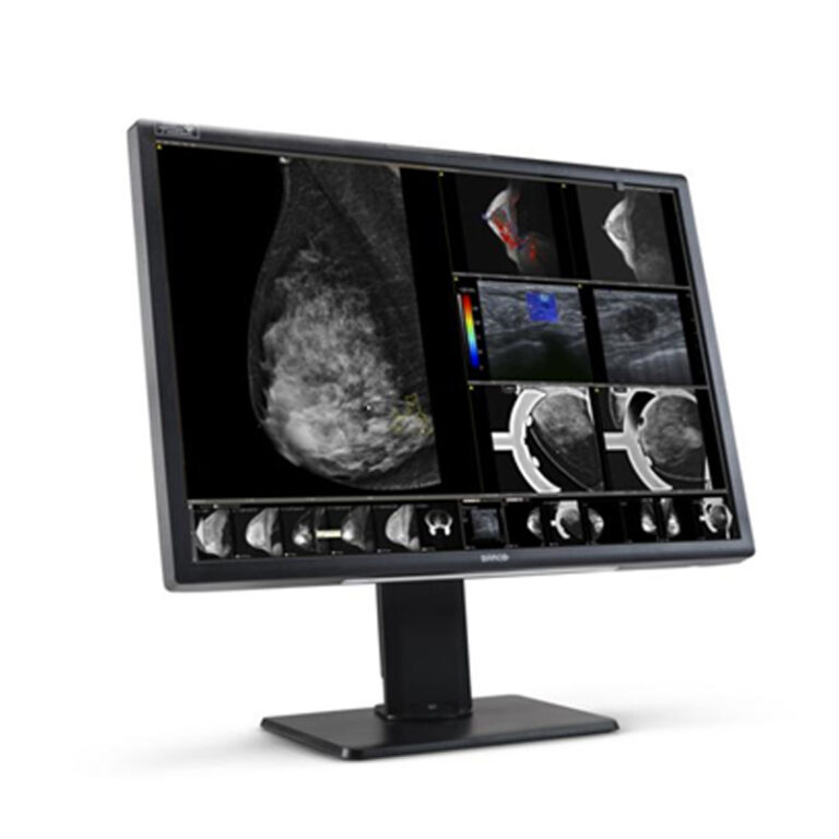 Nio Fusion 12MP (MDNC-12130) | MDA Tech Medical
